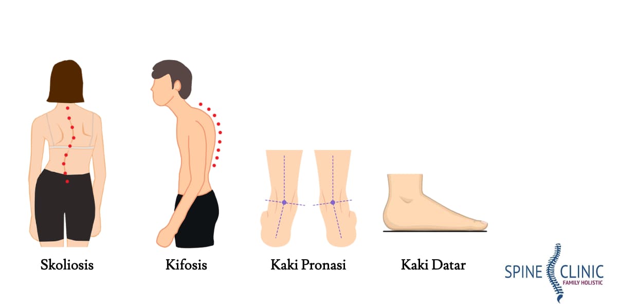 Sekolah Trimulia | Klinik Tulang Belakang